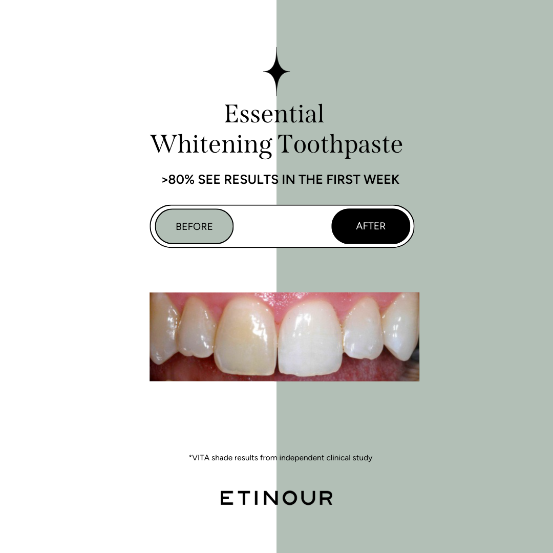 Essential Whitening Toothpaste – Etinour